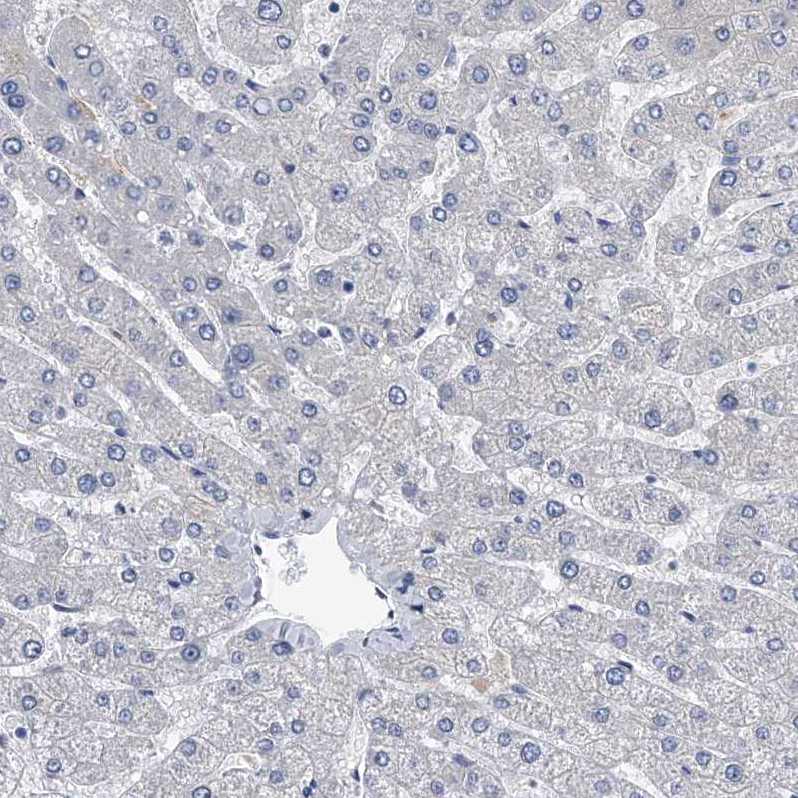 Rabbit Polyclonal Anti-SPP1 Antibody - Buy for research - Highly ...