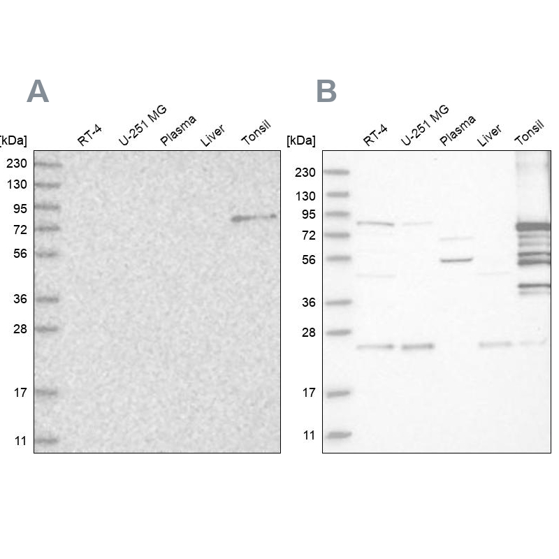 Rabbit Polyclonal Anti-PKP1 Antibody - Buy for research - Highly ...