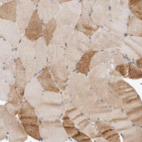 Rabbit Polyclonal Anti-PANK4 Antibody - Buy for research - Highly ...