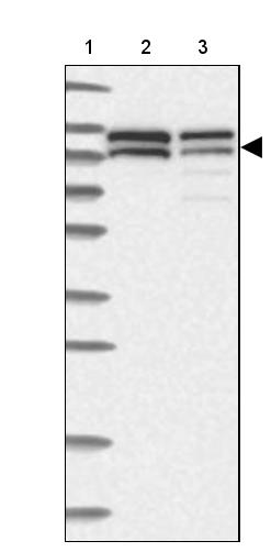 Rabbit Polyclonal Anti-NVL Antibody - Buy for research - Highly specific, rigorously validated ...
