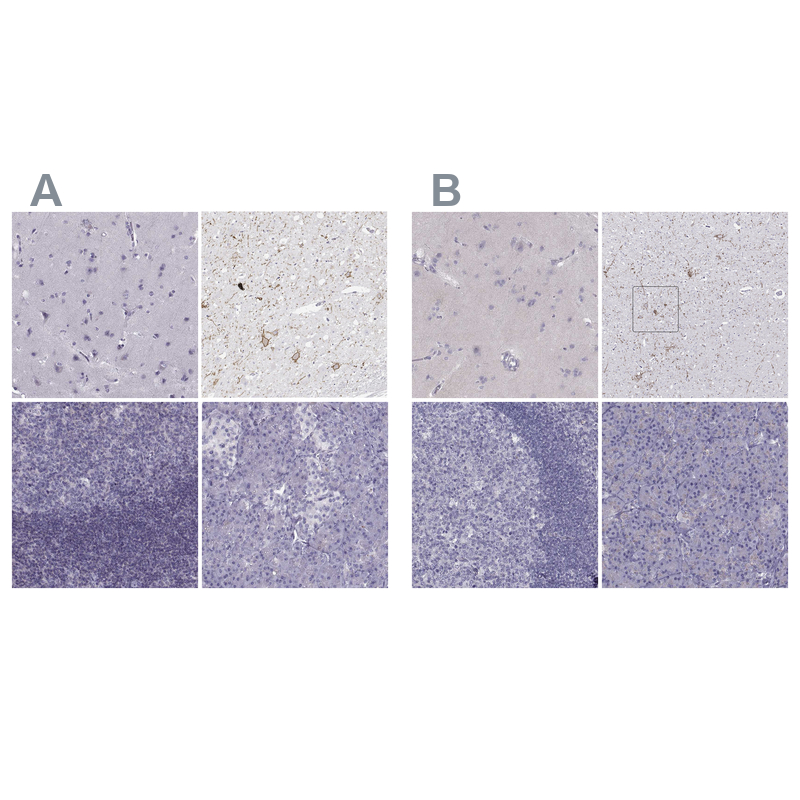 Rabbit Polyclonal Anti-CALCR Antibody - Buy for research - Highly ...