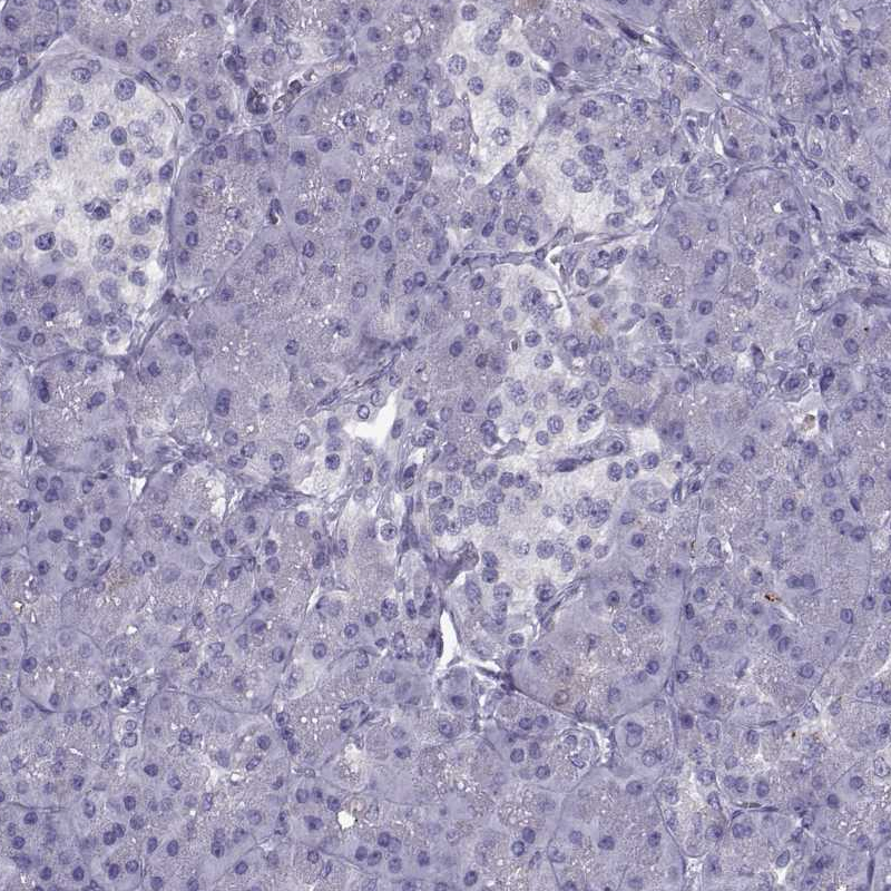 Rabbit Polyclonal Anti-CALCR Antibody - Buy for research - Highly ...