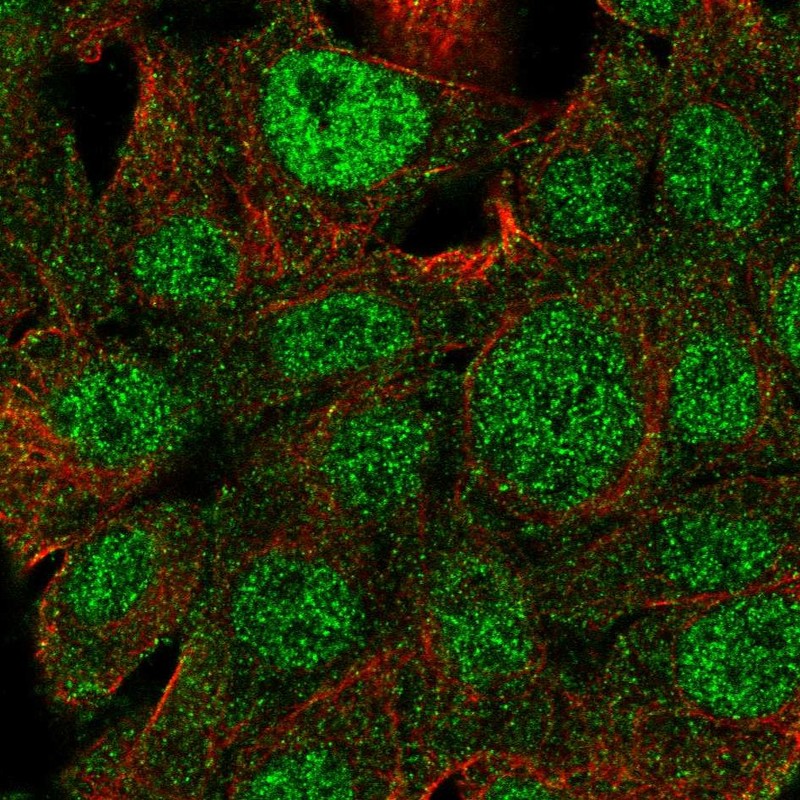 Rabbit Polyclonal Anti-SLC2A2 Antibody - Buy for research - Highly ...