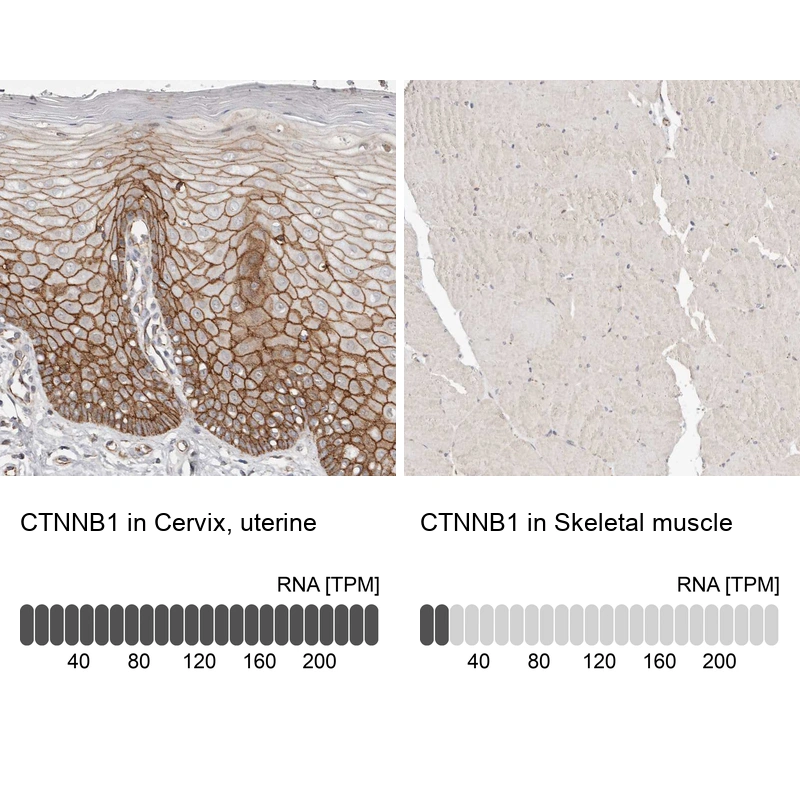 Rabbit Polyclonal Anti-CTNNB1 Antibody - Buy for research - Highly ...