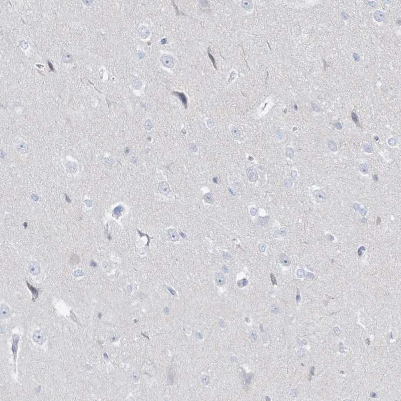 Rabbit Polyclonal Anti-DMKN Antibody - Buy for research - Highly ...