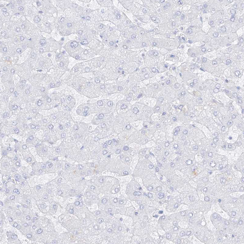 Rabbit Polyclonal Anti-DMKN Antibody - Buy for research - Highly ...