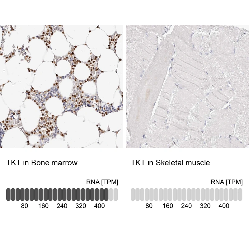 Rabbit Polyclonal Anti-TKT Antibody - Buy for research - Highly ...