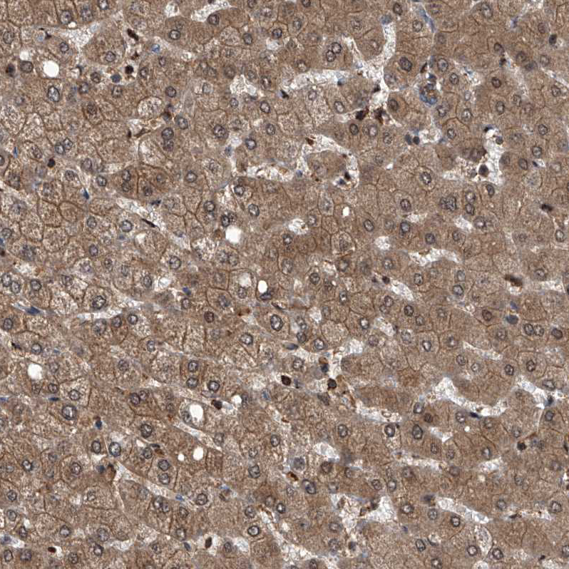 Rabbit Polyclonal Anti-PSMB1 Antibody - Buy for research - Highly ...