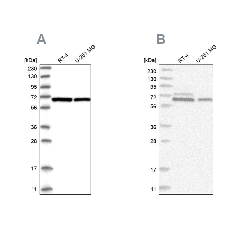 Rabbit Polyclonal Anti-PGM3 Antibody - Buy for research - Highly specific, rigorously validated ...