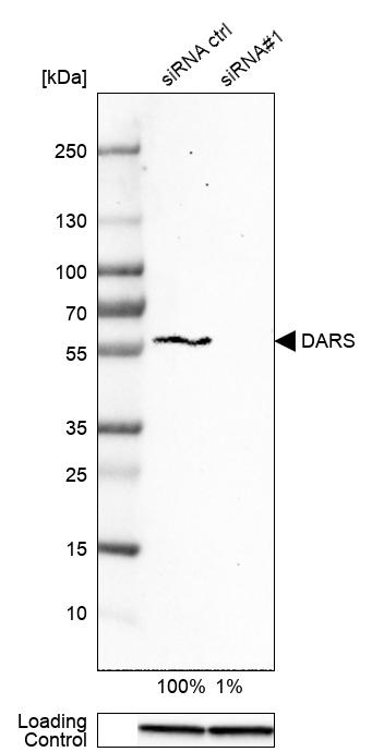 Rabbit Polyclonal Anti-DARS Antibody - Buy for research - Highly ...