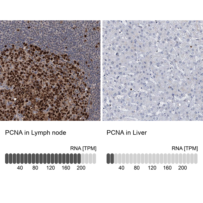 Rabbit Polyclonal Anti-PCNA Antibody - Buy for research - Highly ...