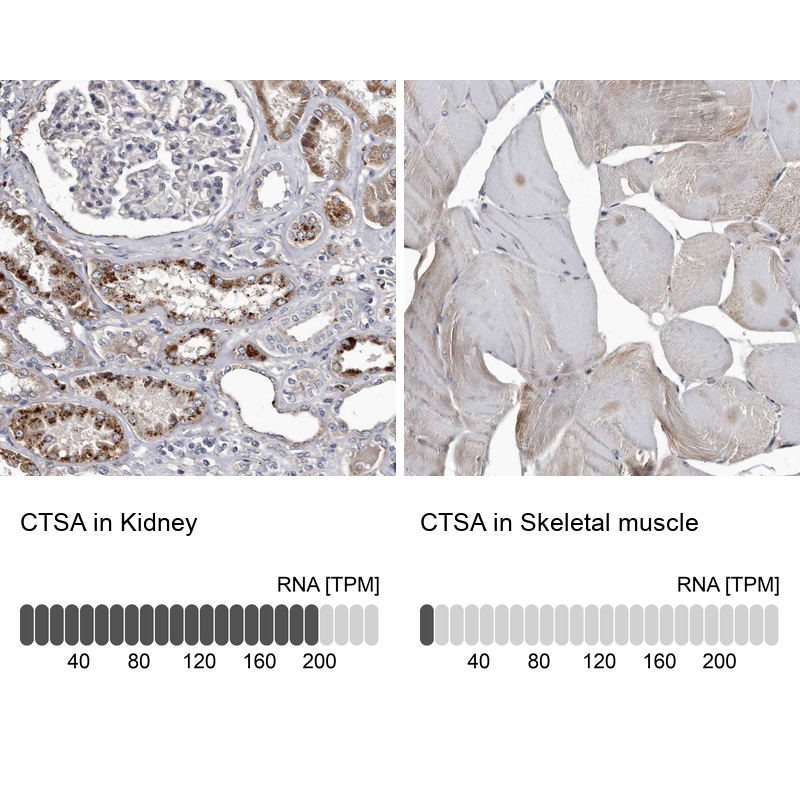 Rabbit Polyclonal Anti-CTSA Antibody - Buy for research - Highly ...
