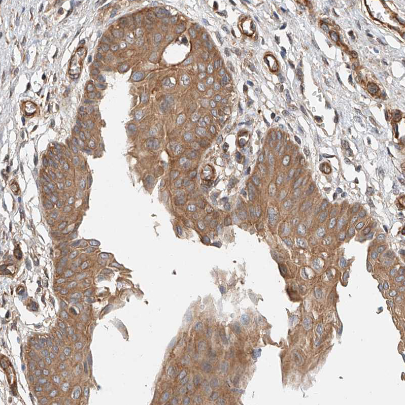 Rabbit Polyclonal Anti-GHDC Antibody - Buy for research - Highly ...