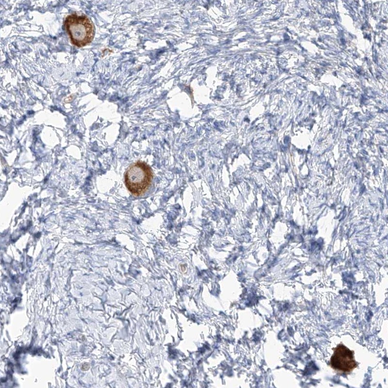 Rabbit Polyclonal Anti-TMEM209 Antibody - Buy for research - Highly ...