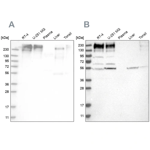 Anti-SON Human Protein Atlas Antibody