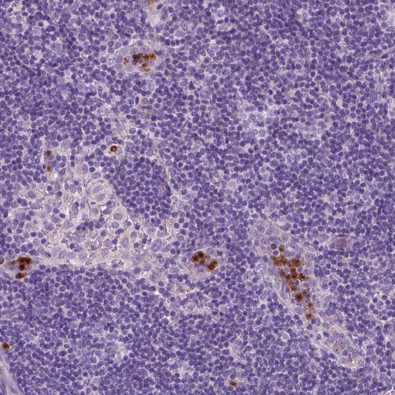 Rabbit Polyclonal Anti-CXCR2 Antibody - Buy for research - Highly ...