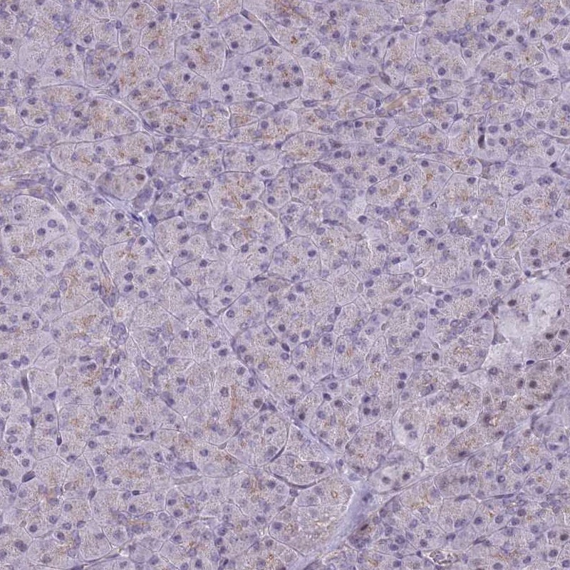 Rabbit Polyclonal Anti-ADD2 Antibody - Buy for research - Highly ...