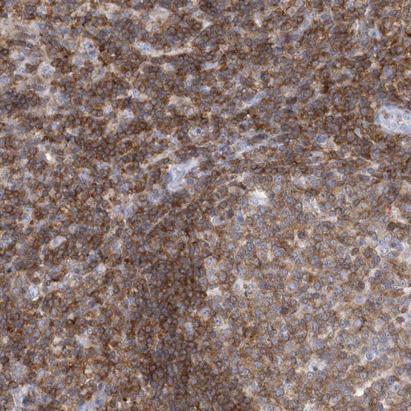 Rabbit Polyclonal Anti-PSD4 Antibody - Buy for research - Highly ...