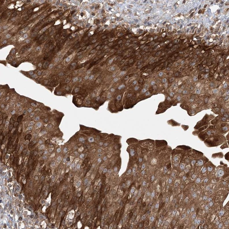 Rabbit Polyclonal Anti-ACAP2 Antibody - Buy for research - Highly ...