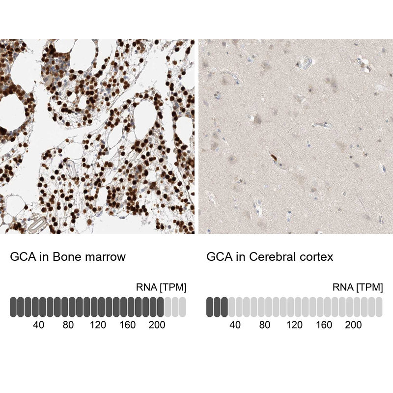 Rabbit Polyclonal Anti-GCA Antibody - Buy for research - Highly ...