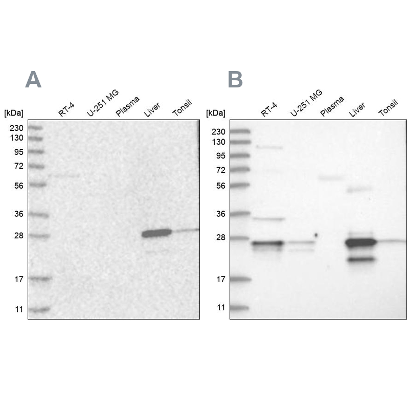 Rabbit Polyclonal Anti-GCA Antibody - Buy for research - Highly ...