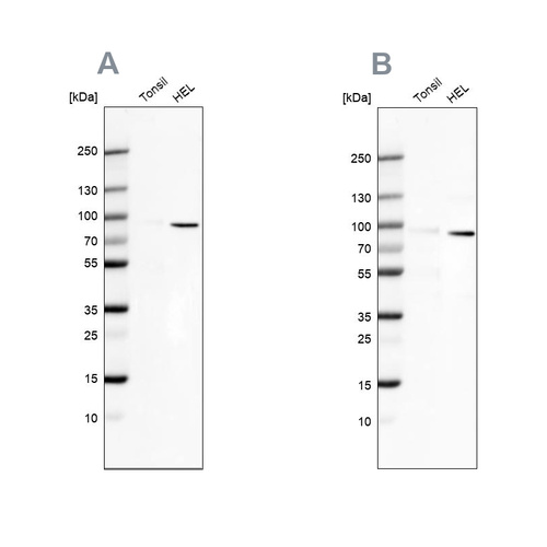 Rabbit Polyclonal Anti-ARHGAP25 Antibody - Buy for research - Highly ...