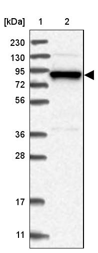 Rabbit Polyclonal Anti-ADD3 Antibody - Buy for research - Highly ...