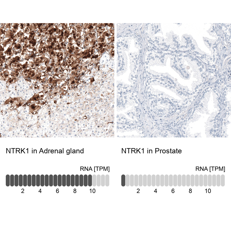 Rabbit Polyclonal Anti-NTRK1 Antibody - Buy for research - Highly ...