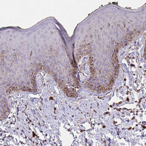 Anti-FCER1A Human Protein Atlas Antibody