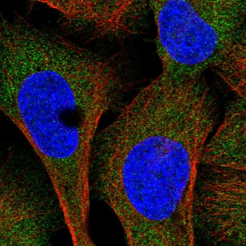 Rabbit Polyclonal Anti-UMPS Antibody - Buy for research - Highly ...