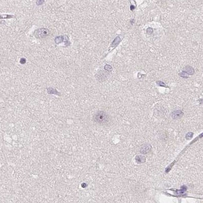 Rabbit Polyclonal Anti-ZBBX Antibody - Buy for research - Highly ...