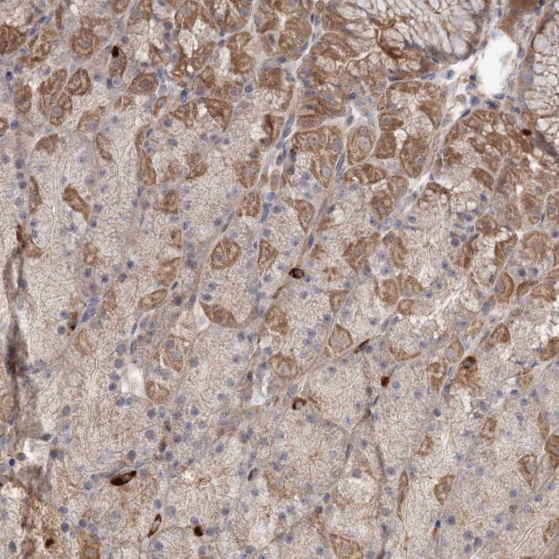 Rabbit Polyclonal Anti-DHRS9 Antibody - Buy for research - Highly ...