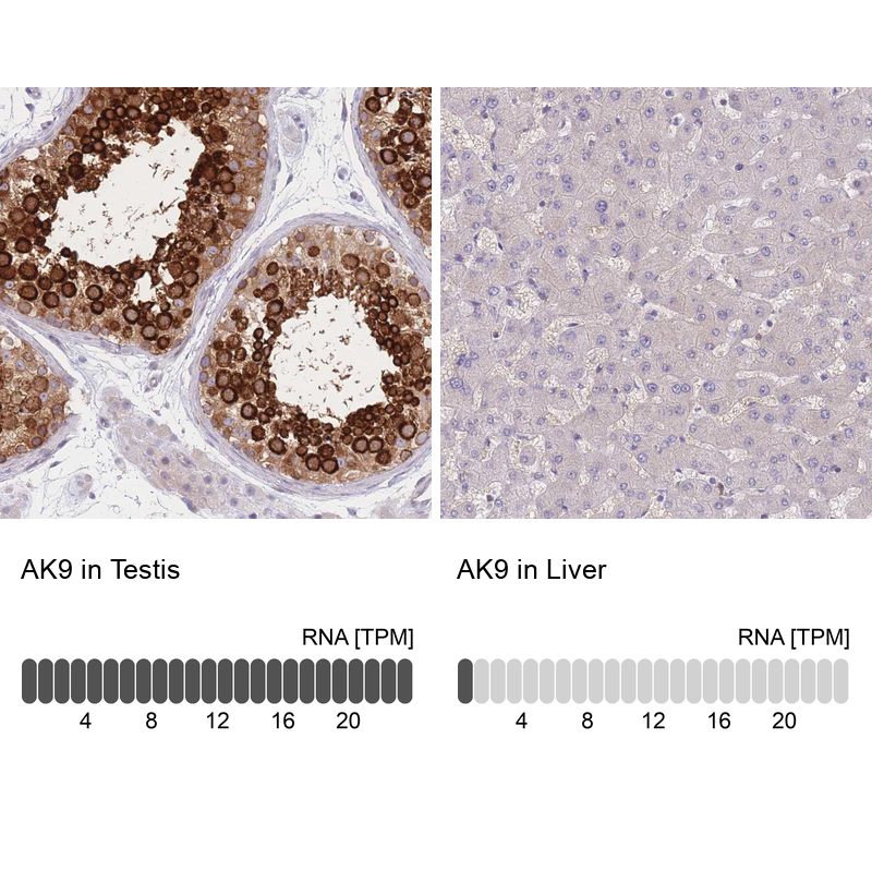 Rabbit Polyclonal Anti-AK9 Antibody - Buy for research - Highly specific, rigorously validated ...