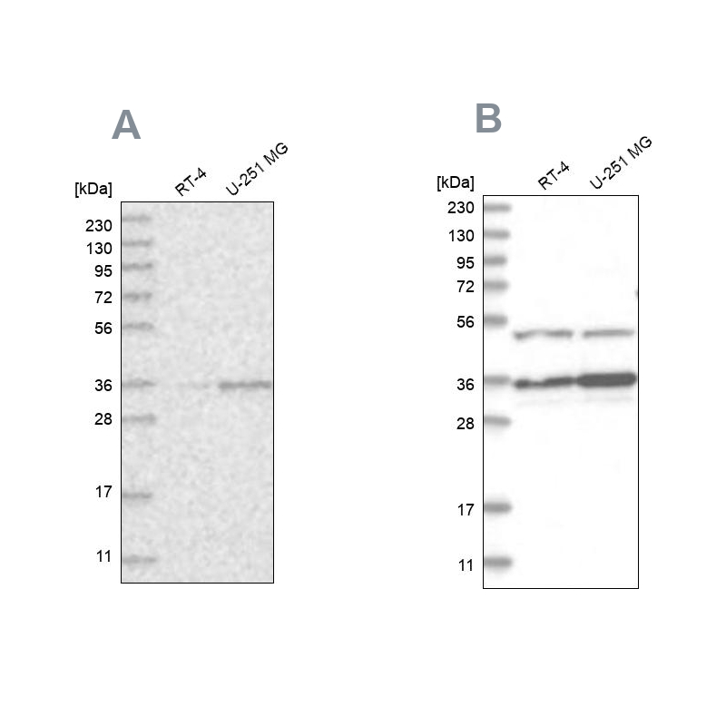 Rabbit Polyclonal Anti-PDHB Antibody - Buy for research - Highly ...