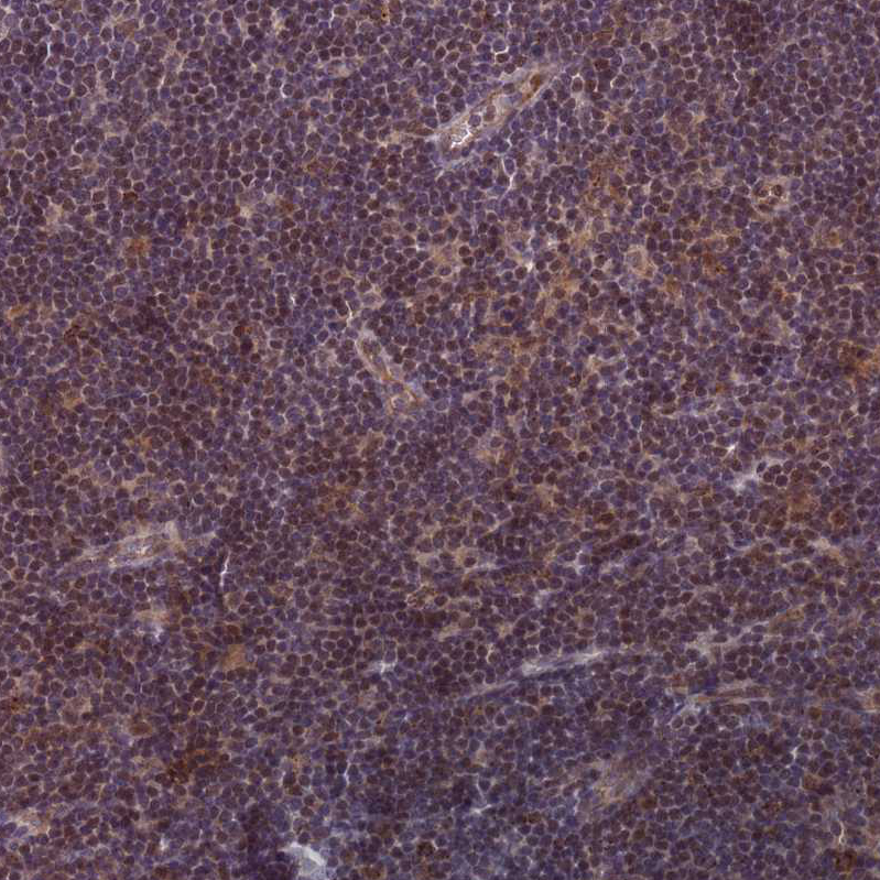 Rabbit Polyclonal Anti-TCF20 Antibody - Buy for research - Highly ...
