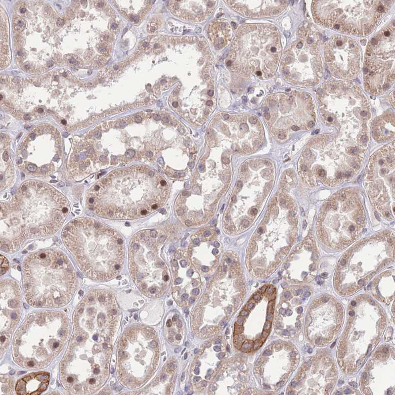 Rabbit Polyclonal Anti-TCF20 Antibody - Buy for research - Highly ...