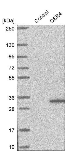 Rabbit Polyclonal Anti-CBR4 Antibody - Buy for research - Highly ...