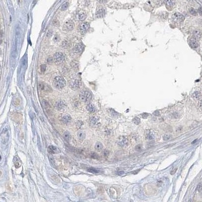 Rabbit Polyclonal Anti-MYOT Antibody - Buy for research - Highly ...