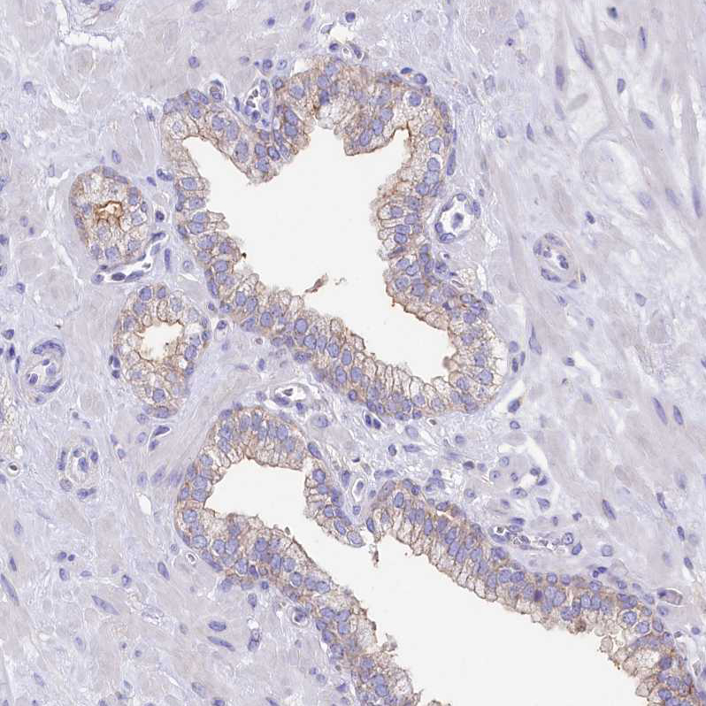 Rabbit Polyclonal Anti-VPS26B Antibody - Buy for research - Highly ...