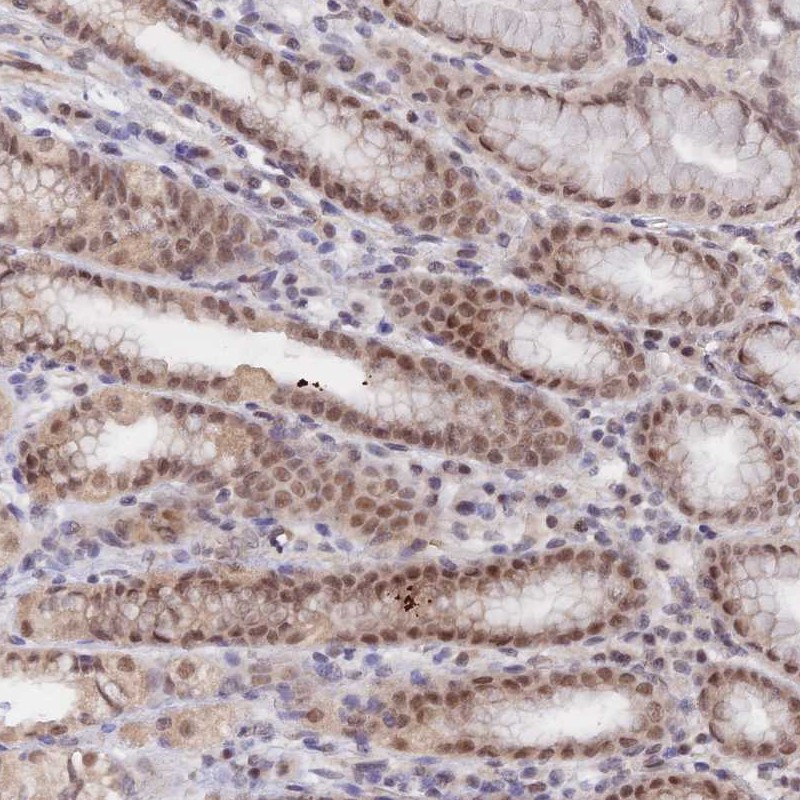Rabbit Polyclonal Anti-ANAPC4 Antibody - Buy for research - Highly ...