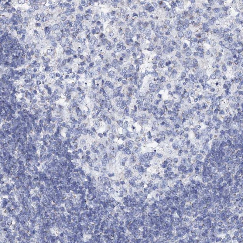 Rabbit Polyclonal Anti-SLC37A4 Antibody - Buy for research - Highly ...