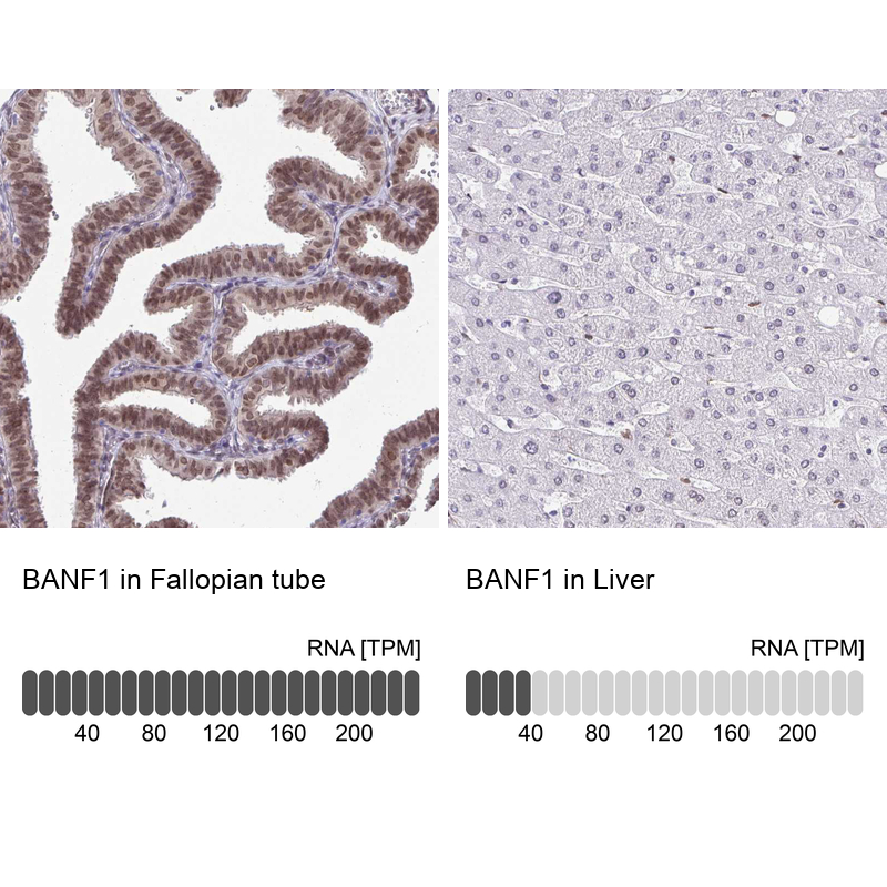 Rabbit Polyclonal Anti-BANF1 Antibody - Buy for research - Highly specific, rigorously validated ...