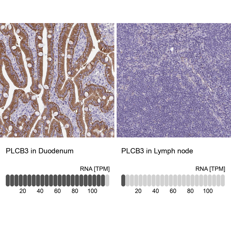 Rabbit Polyclonal Anti-PLCB3 Antibody - Buy for research - Highly ...