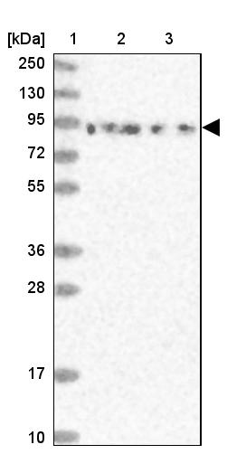 Anti-DDX51 Human Protein Atlas Antibody