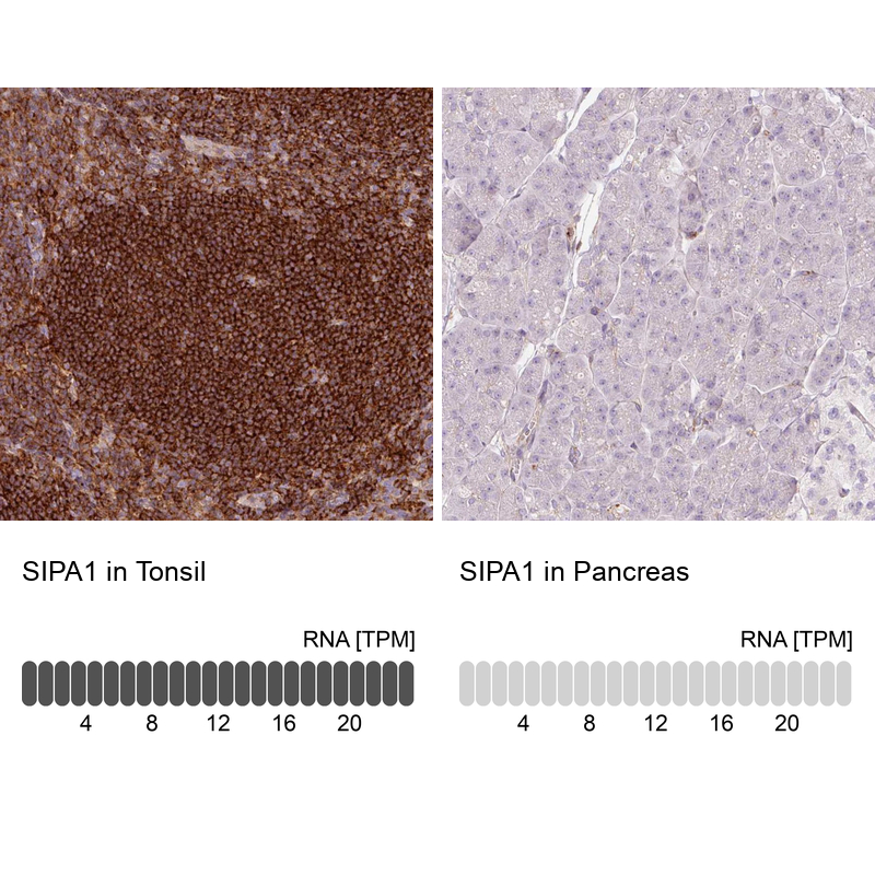 Rabbit Polyclonal Anti-SIPA1 Antibody - Buy for research - Highly ...