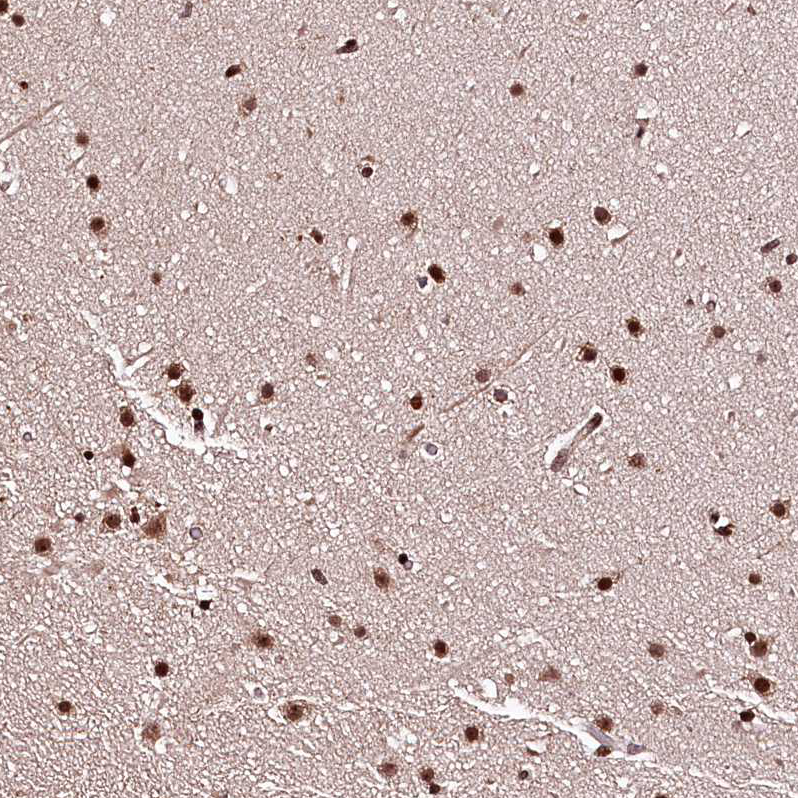 Rabbit Polyclonal Anti-PDS5B Antibody - Buy for research - Highly ...