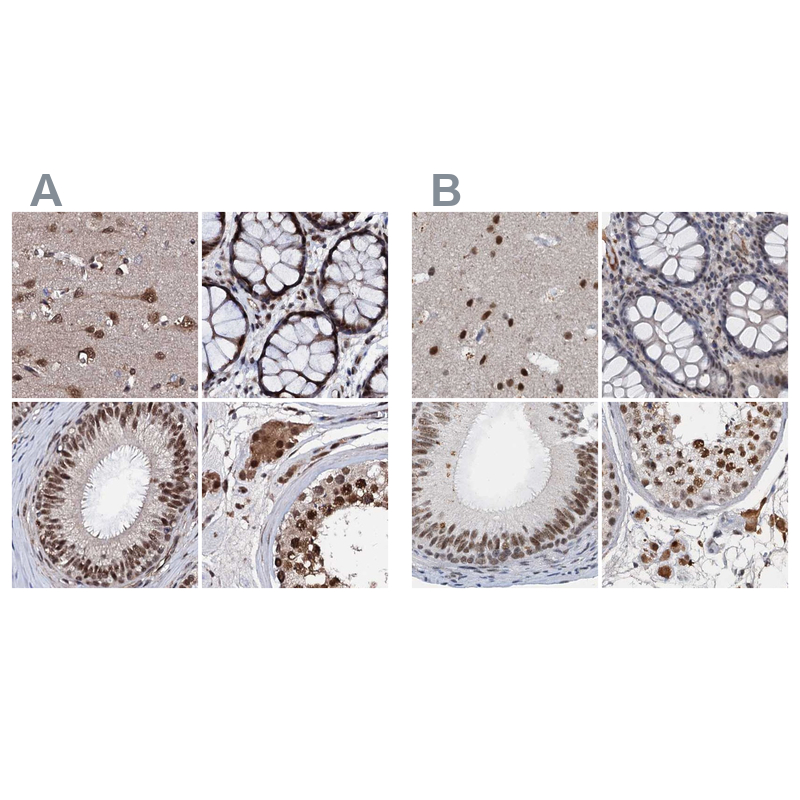 Rabbit Polyclonal Anti-CSTF3 Antibody - Buy for research - Highly specific, rigorously validated ...