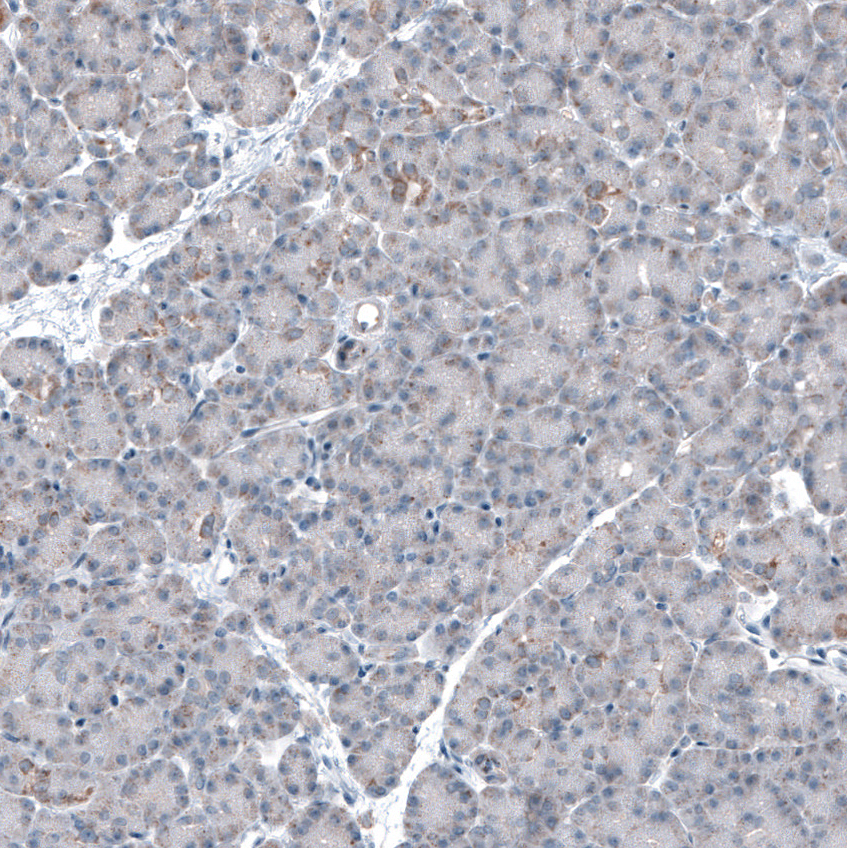 Rabbit Polyclonal Anti-CEP192 Antibody - Buy for research - Highly ...