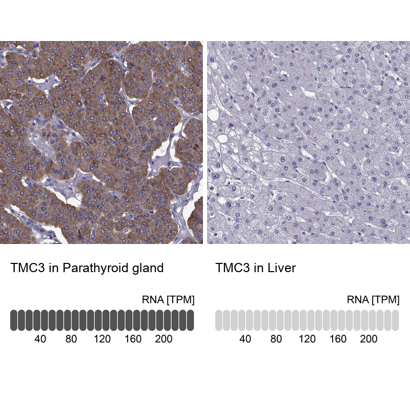 Rabbit Polyclonal Anti-TMC3 Antibody - Buy for research - Highly ...