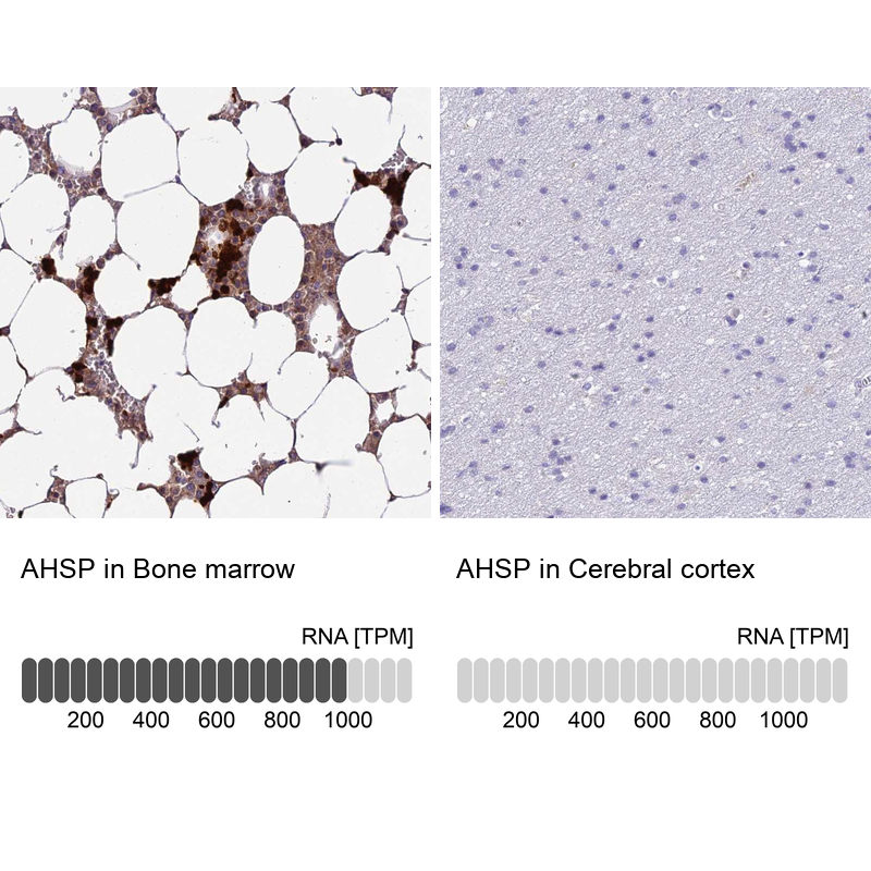 Rabbit Polyclonal Anti-AHSP Antibody - Buy for research - Highly ...
